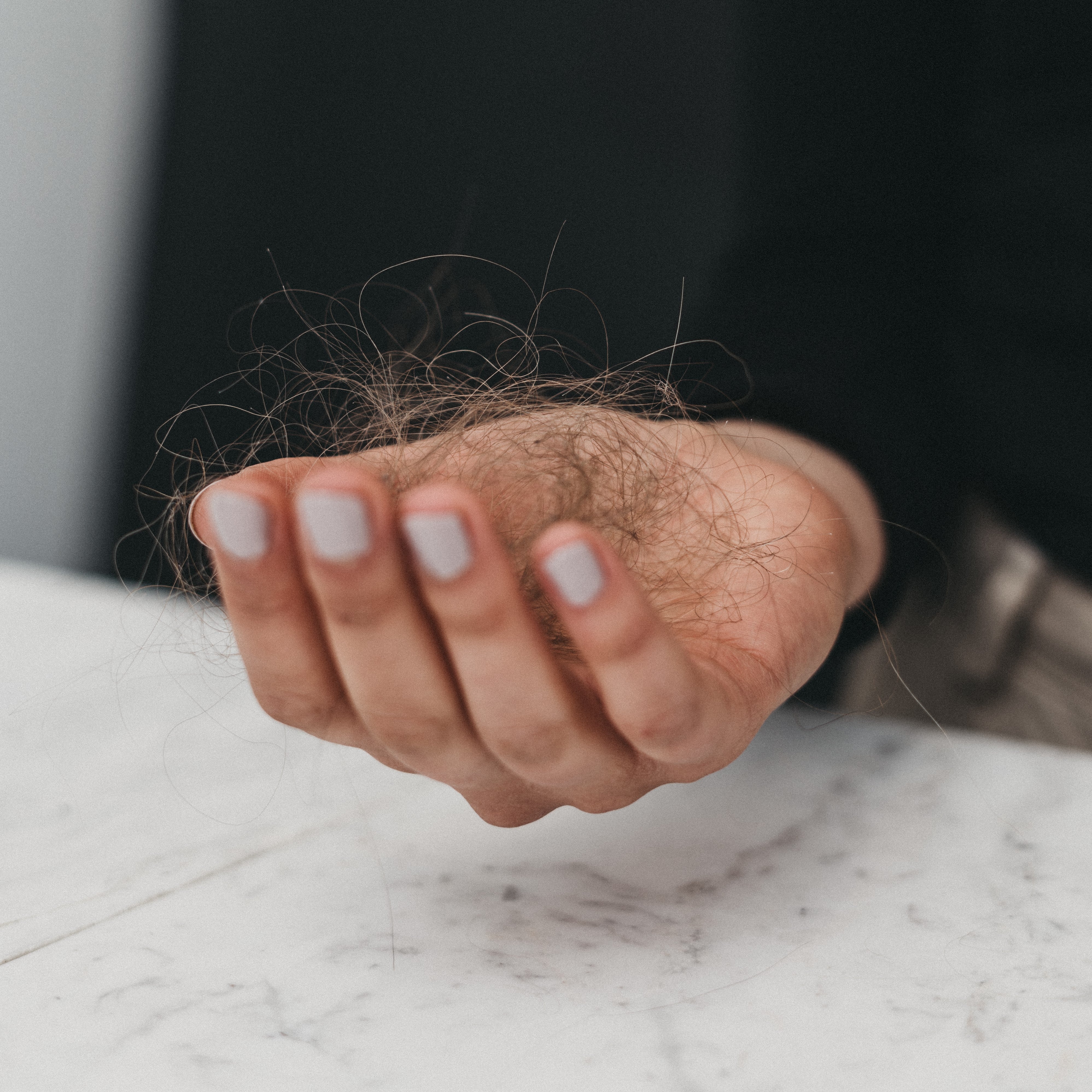 Early Signs of Balding And How To Fix It? – Scandinavianbiolabs.com